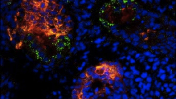 First iPS stem cell retina surgery performed in Japan – The Mail & Guardian