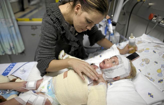 Pippie Kruger miracle more than skin deep for her family – The Mail ...